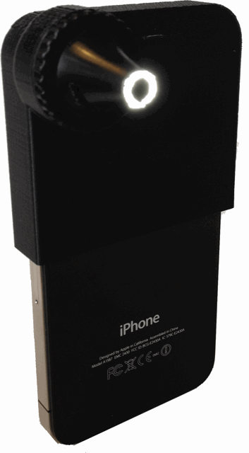 CellScope Oto (formerly known as Remotoscope) | APDC